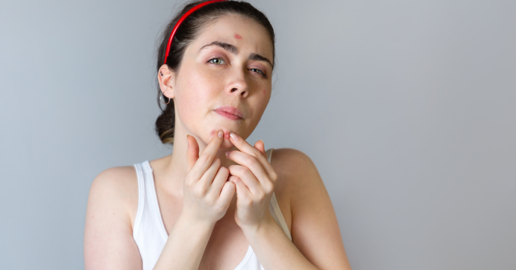 Unterirdische Pickel am Kinn: Ursachen, Tipps und effektive ...